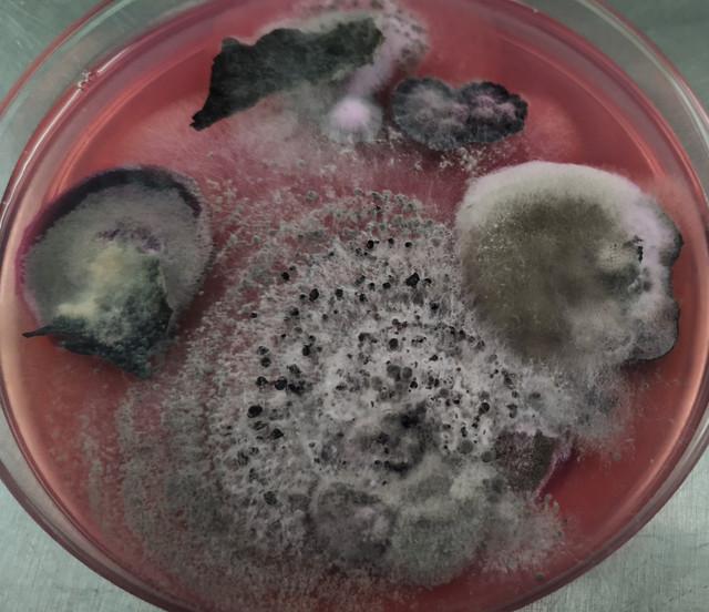 iThink Biology: The kingdom of fungi